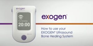 Patient Guides & Videos Archive | EXOGEN Ultrasound Bone Healing System
