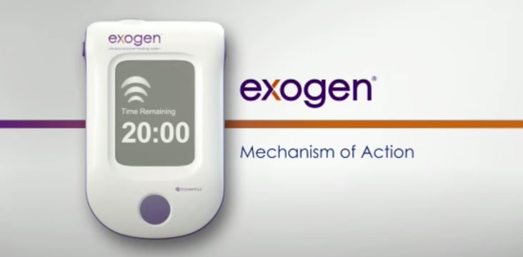 EXOGEN Mechanism of Action | EXOGEN Ultrasound Bone Healing System