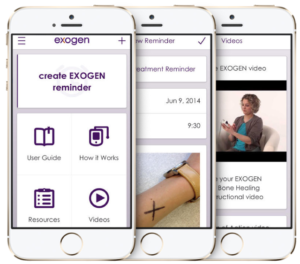 Staying Connected | EXOGEN Ultrasound Bone Healing System