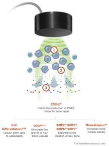 The Science Behind EXOGEN | EXOGEN Ultrasound Bone Healing System
