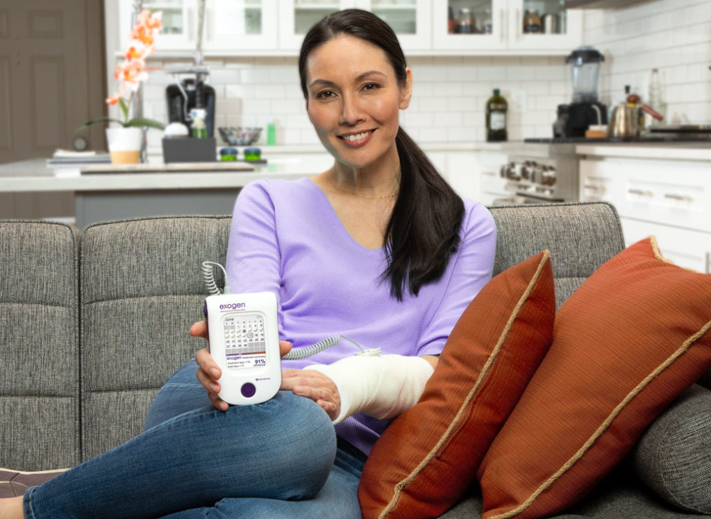 Staying Connected | EXOGEN Ultrasound Bone Healing System