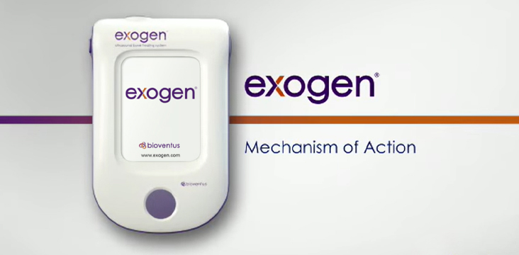 Mecanismo de acción de EXOGEN | EXOGEN Ultrasound Bone Healing System