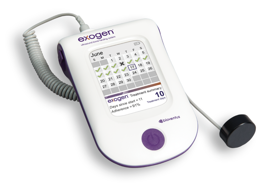 For Providers | EXOGEN Ultrasound Bone Healing System